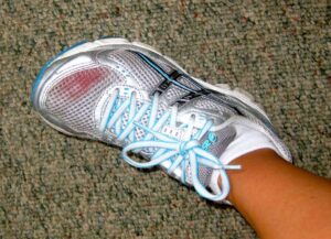 Runner's Toe Prevention and 7 Easy Tips to Keep Running - RunToTheFinish